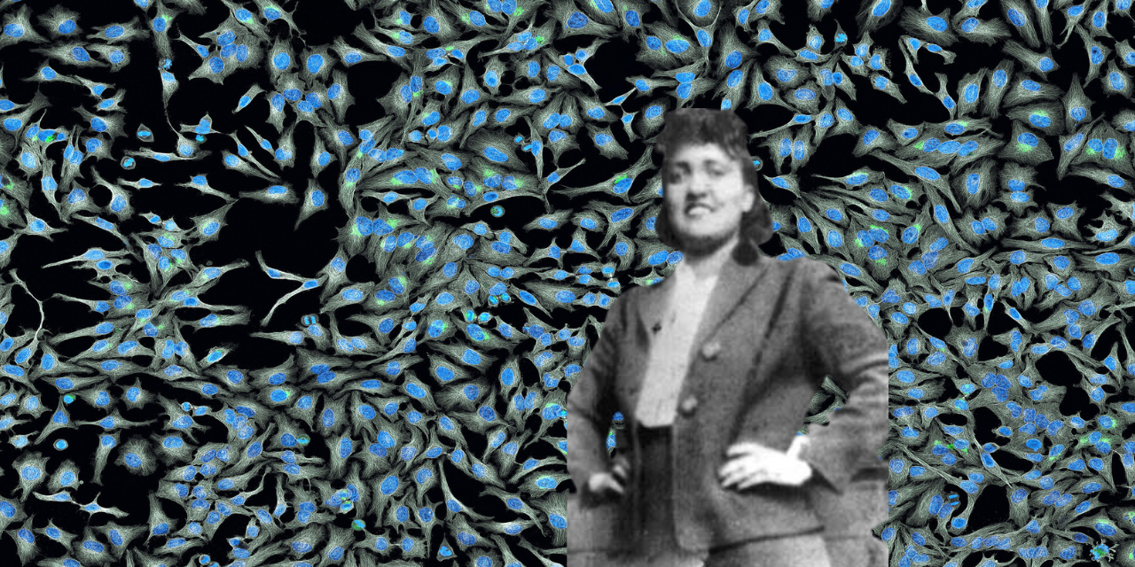 Reflecting on HeLa cells: 70 years on | Babraham Institute